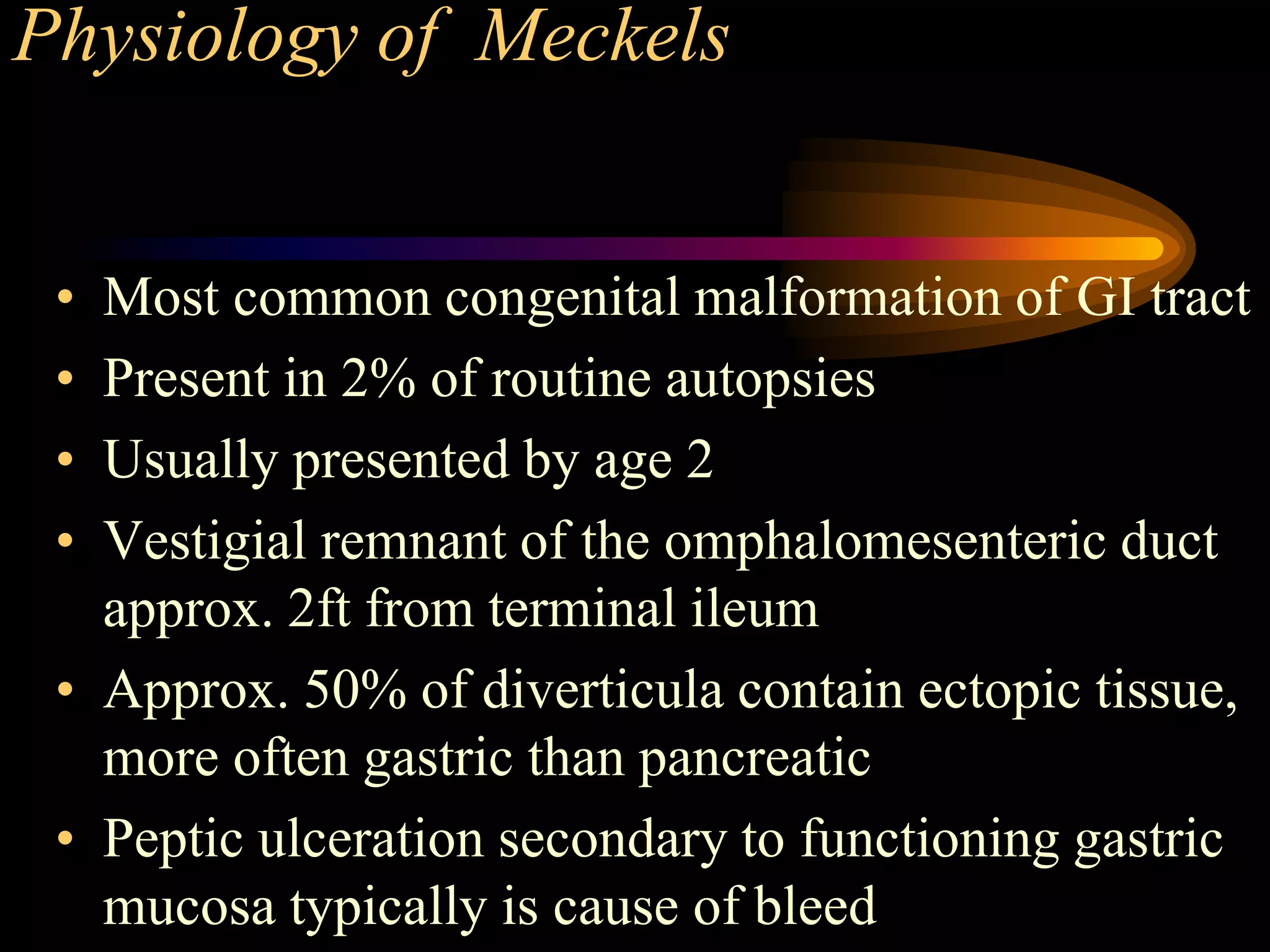 Meckels diverticulum - a nuclear medicine case study | PDF
