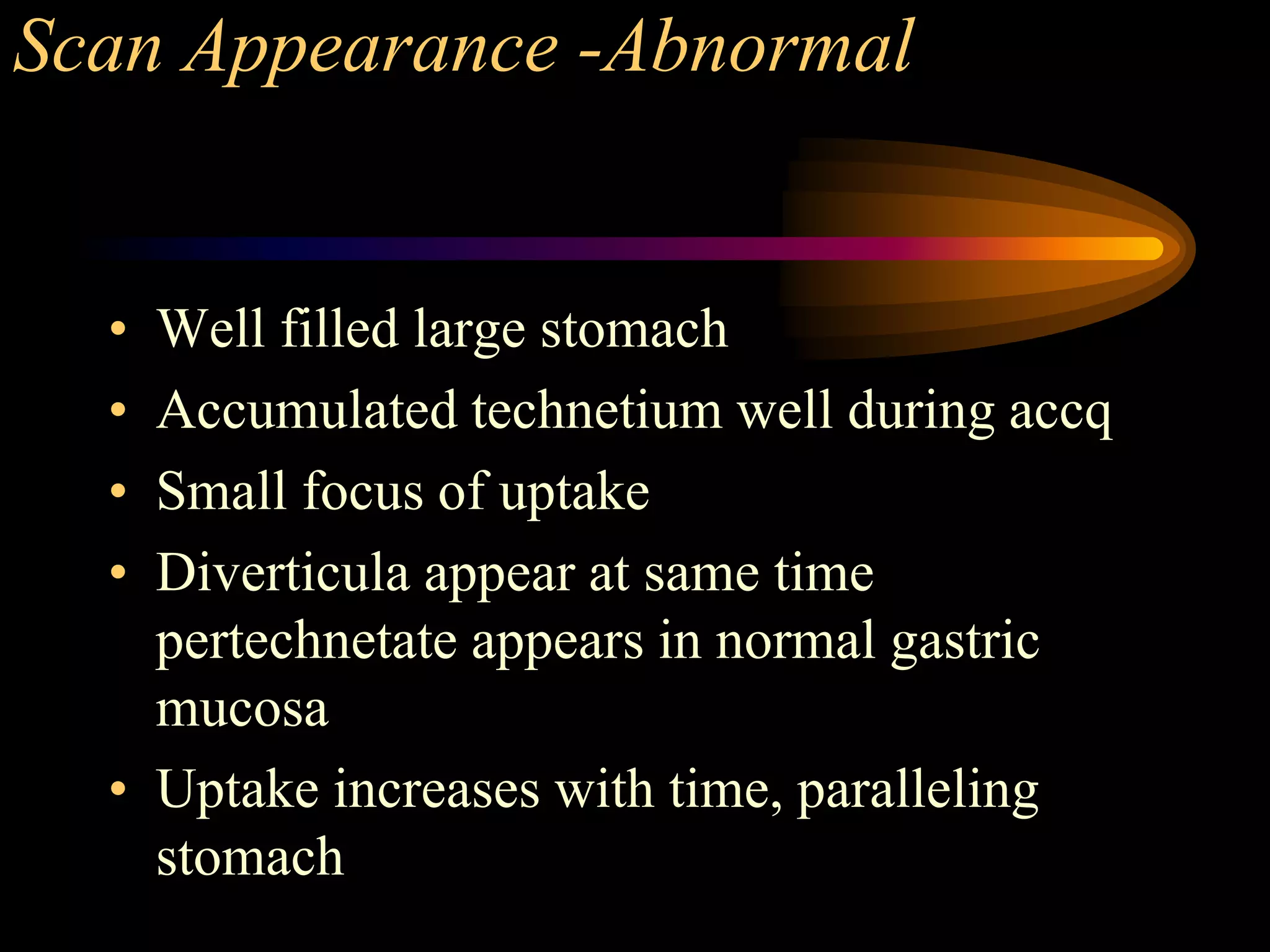 Meckels diverticulum - a nuclear medicine case study | PDF