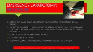 Meckels diverticulum perforation from jujube pit ثقب رتج ميكل الناجم عن ...