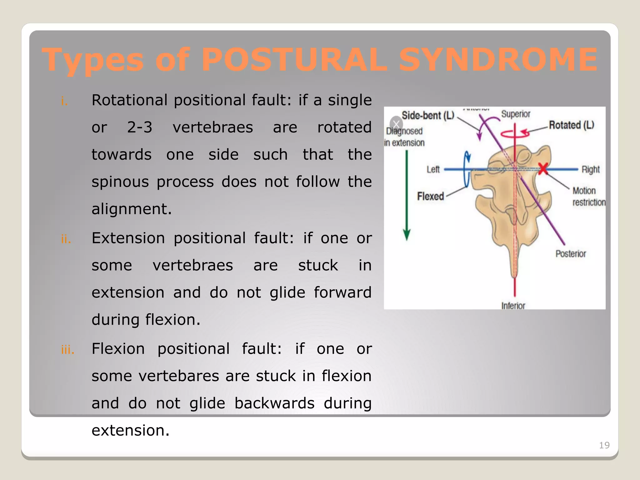 Meckenzie approach | PDF