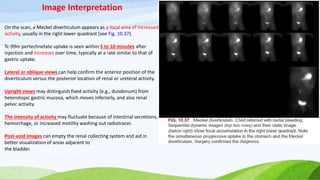 Meckle's scan | PPTX