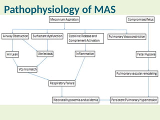 Meconium-Aspiration-Syndrome presentation.pptx