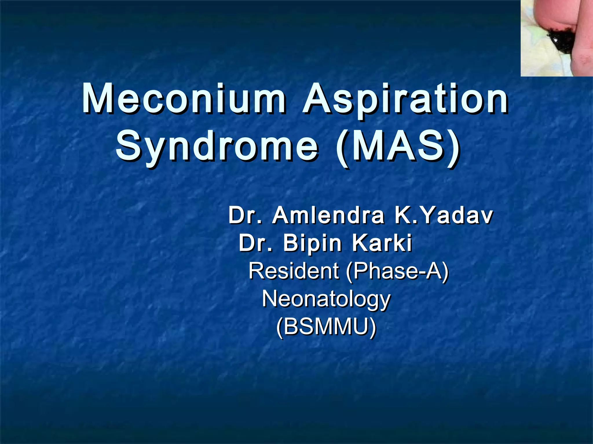 Meconium aspiration syndrome_ | PPT