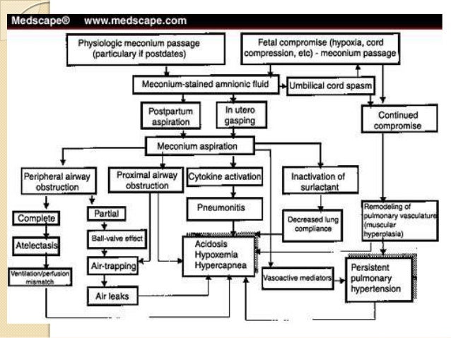 Meconium aspiration syndrome