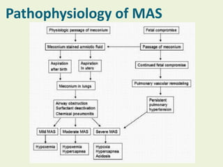 Meconium Aspiration Syndrome | PPTX