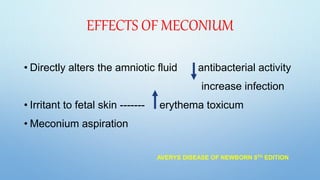 Meconium aspiration syndrome | PPTX