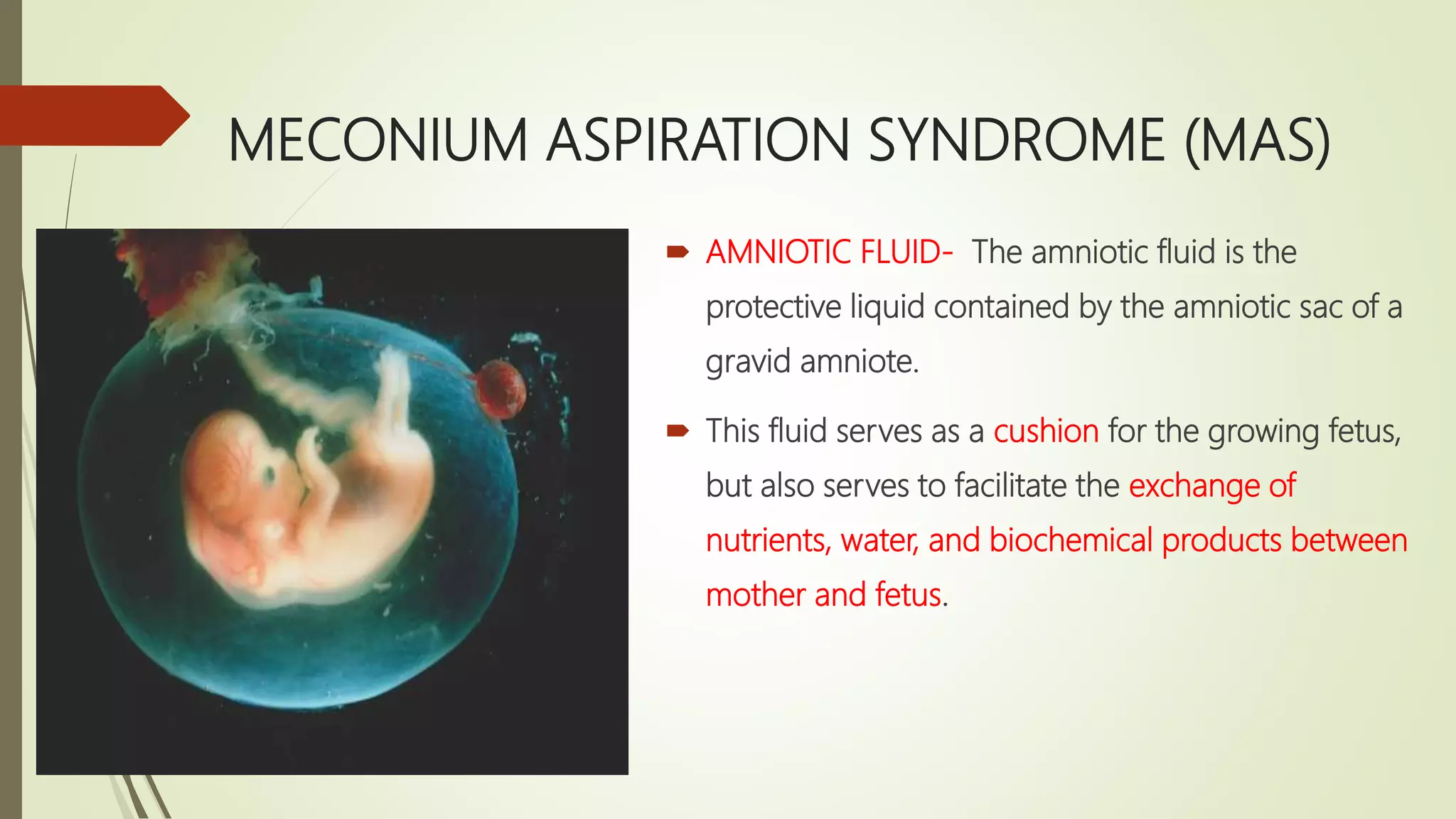 Meconium aspiration syndrome | PPTX