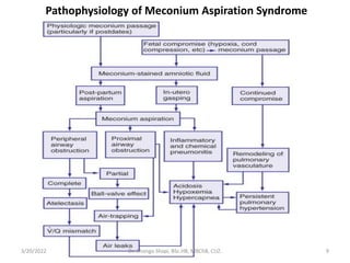 Meconium Aspiration Syndrome.pdf