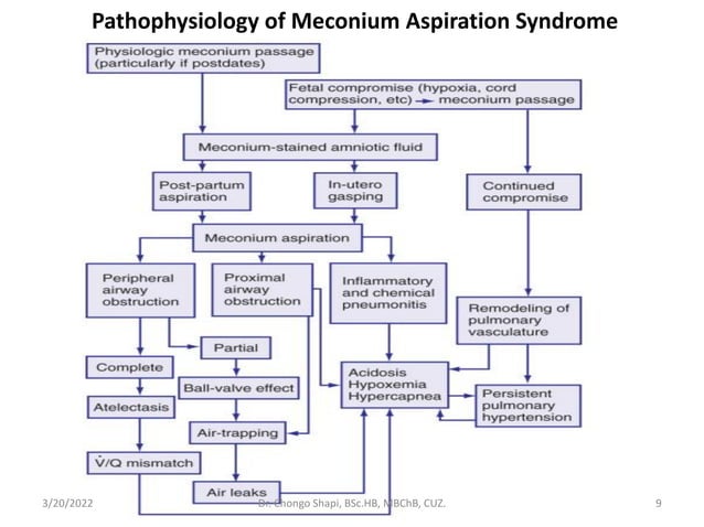 Meconium Aspiration Syndrome.pdf