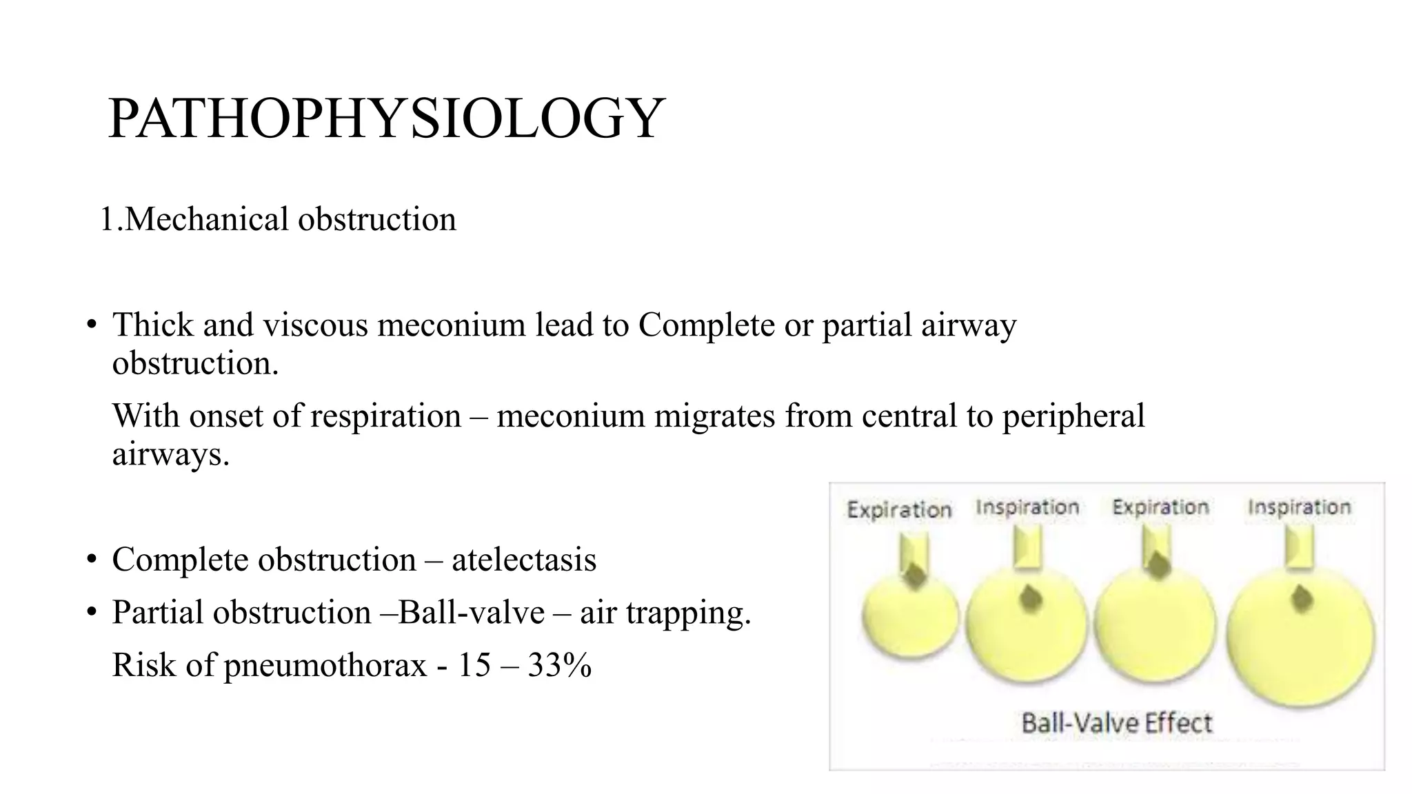 Meconium Aspiration syndrome.pptx