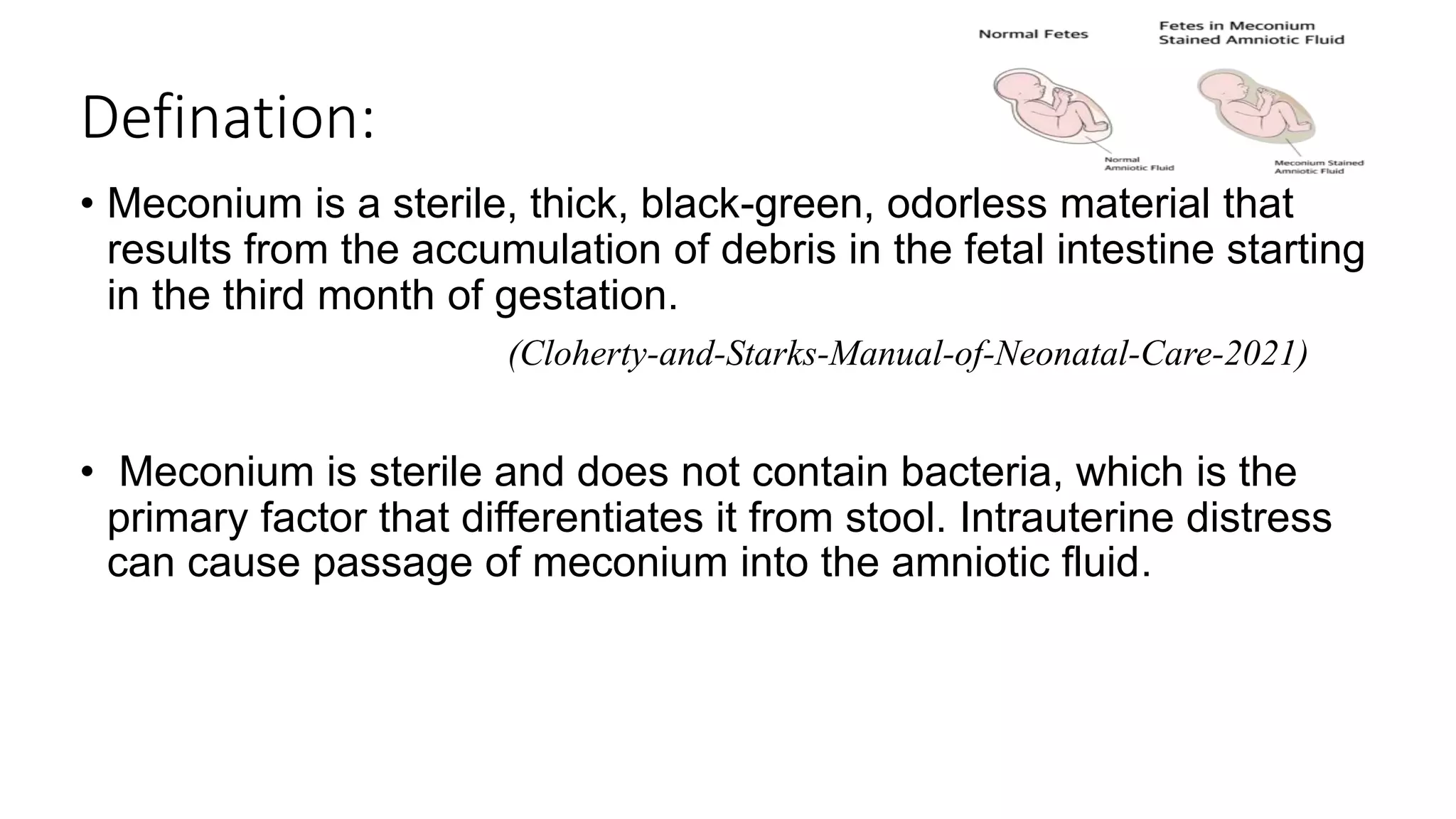 Meconium Aspiration syndrome.pptx