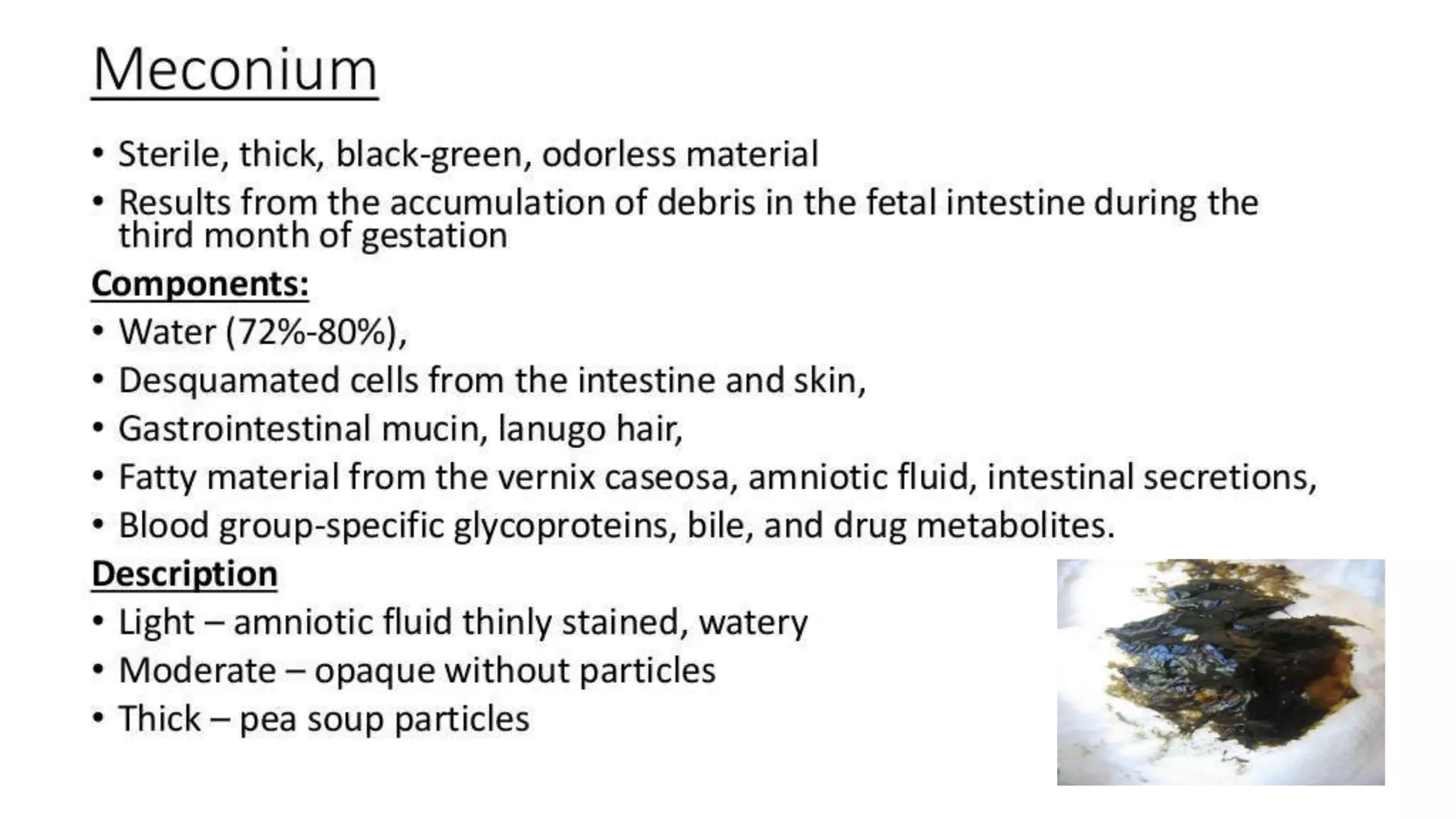 Meconium Aspiration syndrome.pptx