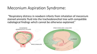 Meconium Aspiration syndrome.pptx