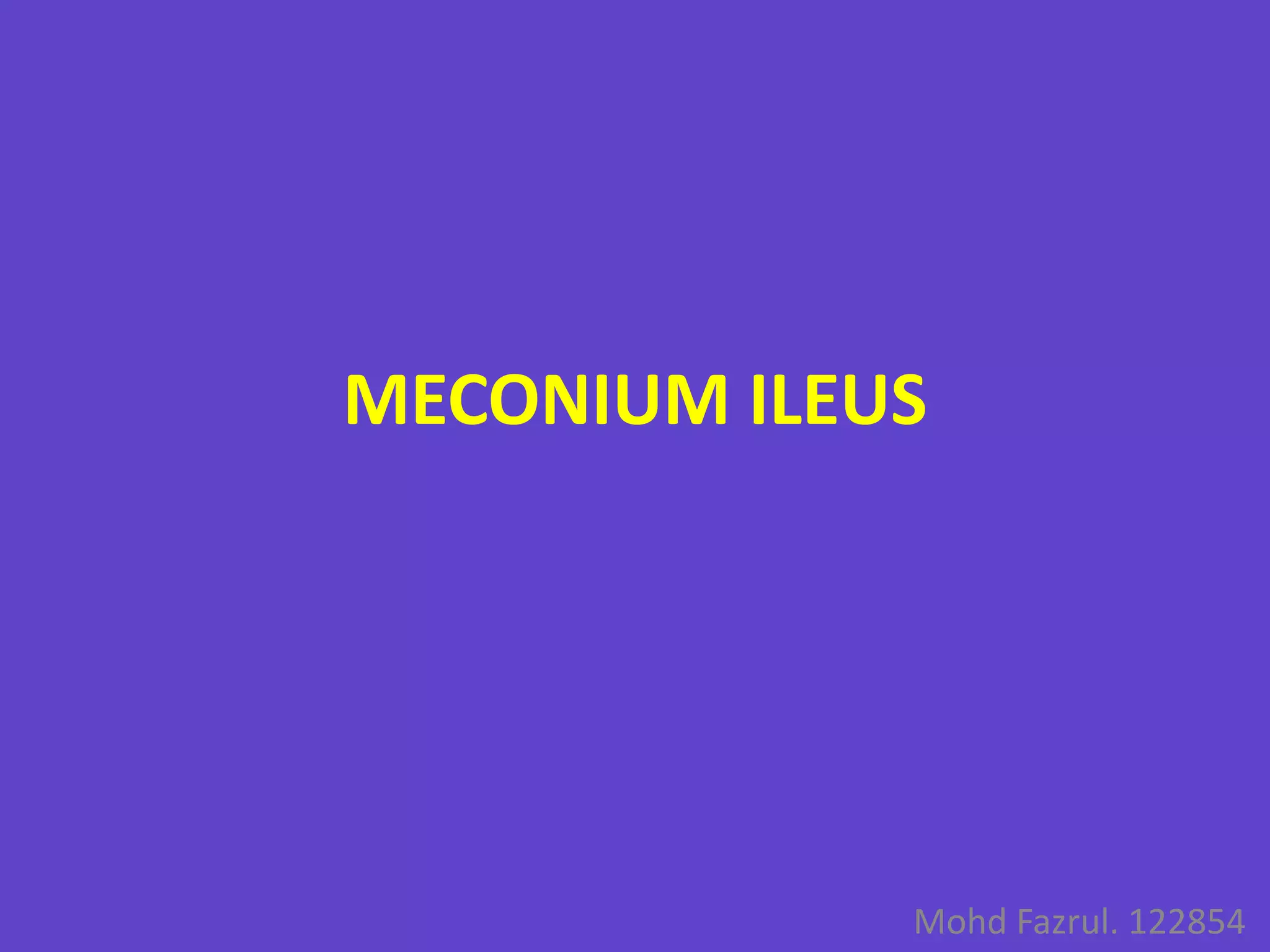 Meconium ileus Simple | PPTX