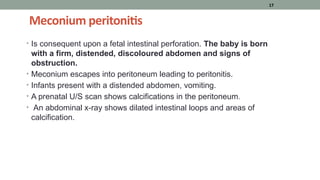 Meconium ileus and peritonitis-1 in children.pptx