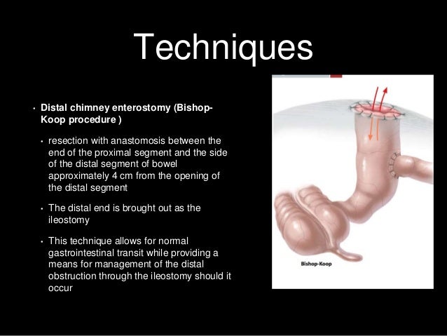 Meconium ileus surgical management