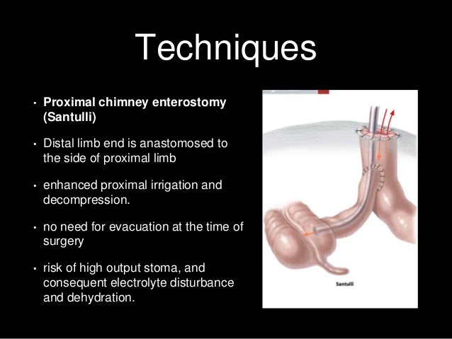 Meconium ileus surgical management