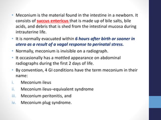Meconium plug + Meconium ileus. Current overview | PPTX