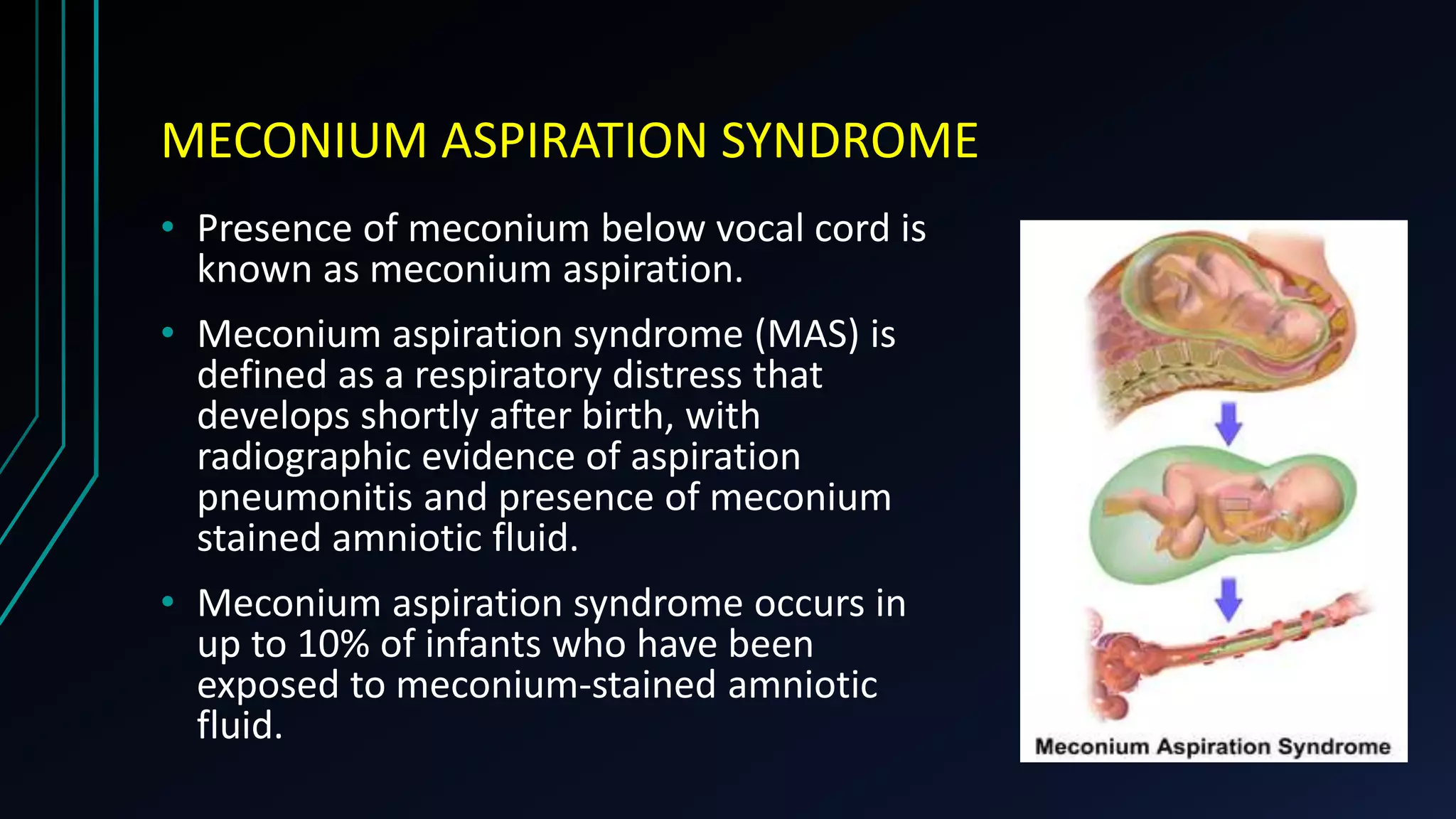 MECONIUM STAINED AMNIOTIC FLUID | PPTX