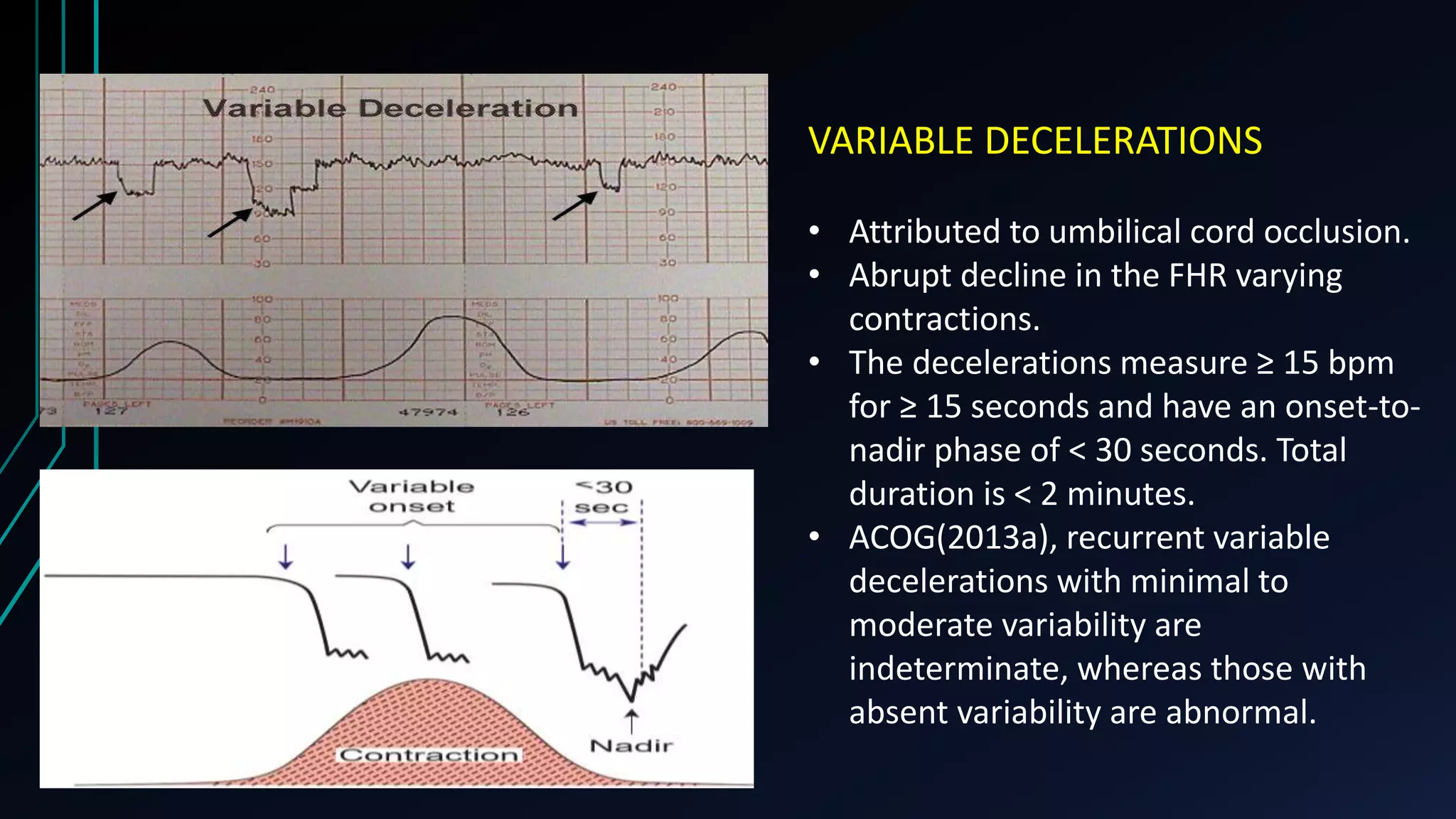 MECONIUM STAINED AMNIOTIC FLUID | PPTX