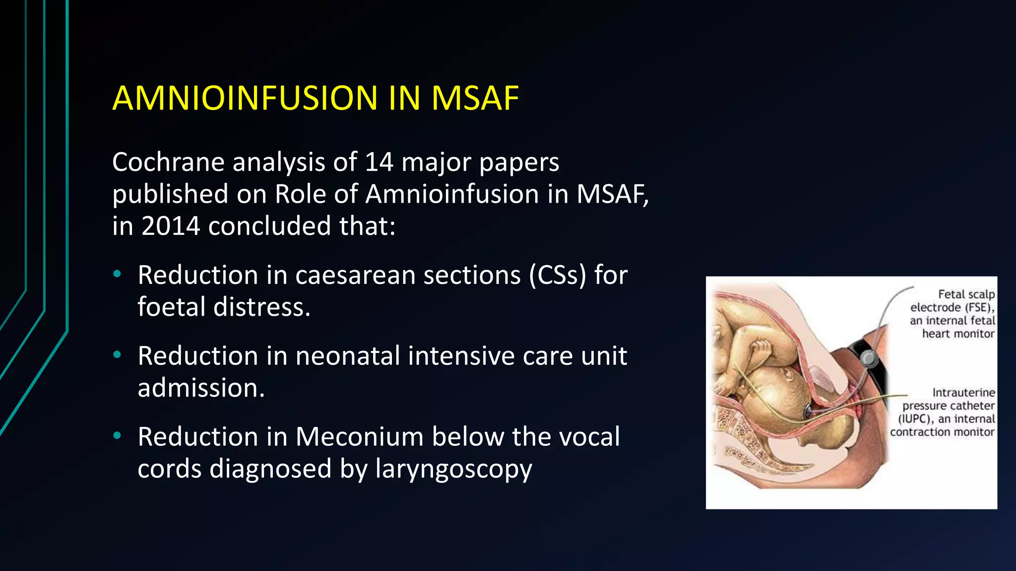 MECONIUM STAINED AMNIOTIC FLUID | PPTX