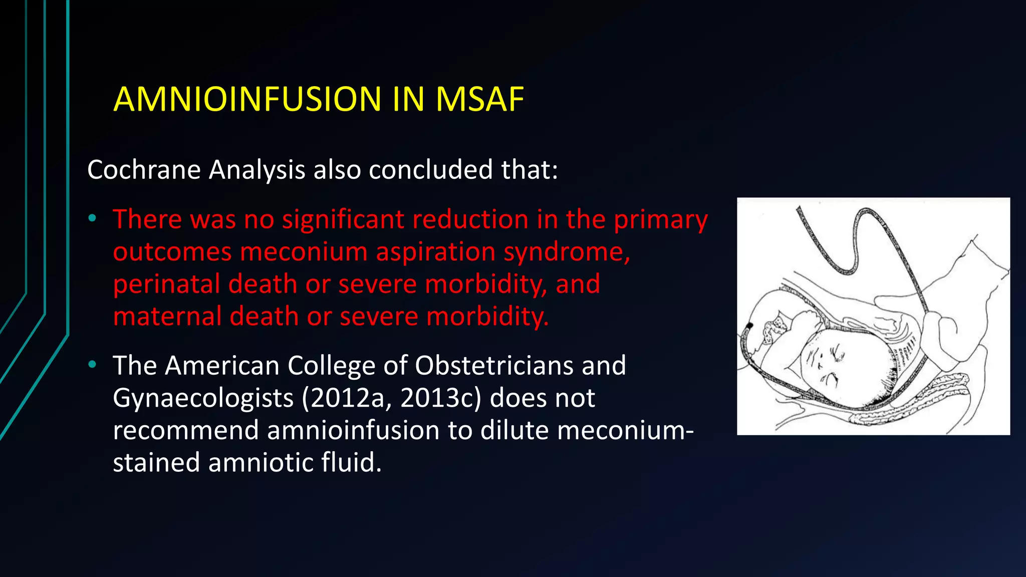 MECONIUM STAINED AMNIOTIC FLUID | PPTX