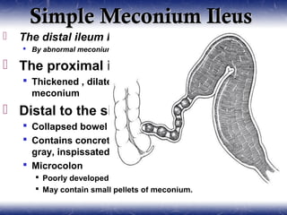 Meconium syndrome and short bowel syndrome | PPT