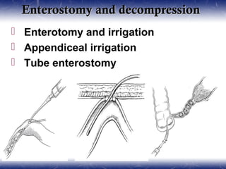 Meconium syndrome and short bowel syndrome | PPT