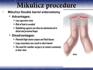 Meconium syndrome and short bowel syndrome | PPT