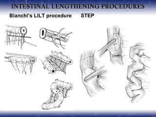 Meconium syndrome and short bowel syndrome | PPT
