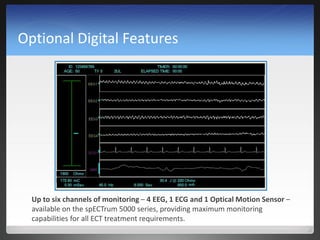 Mecta ppt product overview | PDF