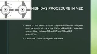 Monocular elevation deficiency | PPTX