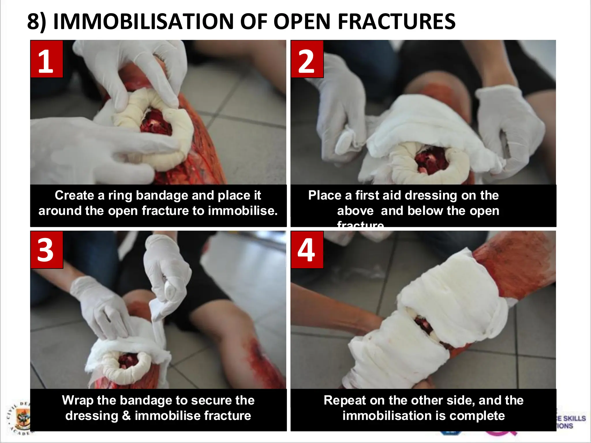(MED 316) Management Of Fractures latest.pdf