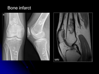 MED401-Rad-Lect- radiological finding of common heamatology disease.ppt