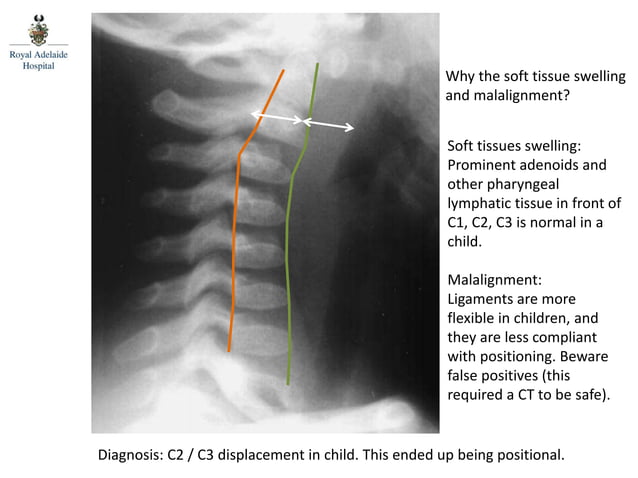 Med 4 ortho spinal cases | PPTX