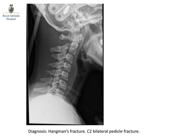 Med 4 ortho spinal cases | PPTX