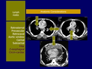 Medastinal lymphadenopathy | PDF | Lung and Respiratory Health ...