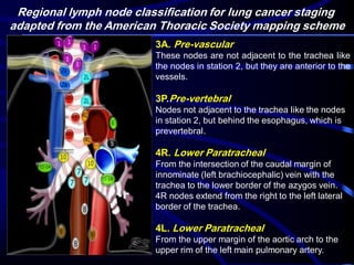 Paratracheal Lymph Nodes Lung Cancer