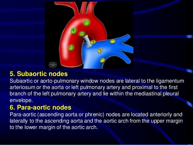 Medastinal lymphadenopathy