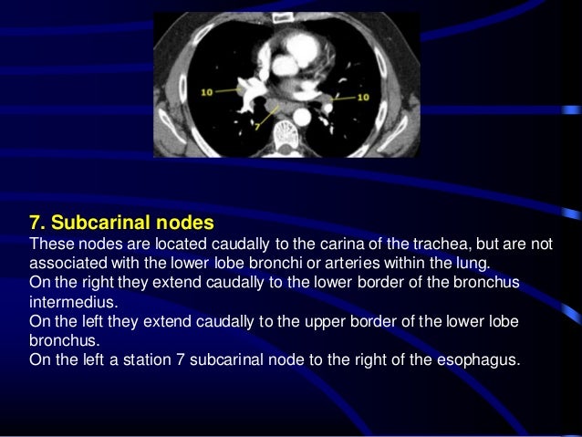 Medastinal lymphadenopathy