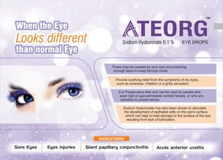 List Of Eye Drop Products Offered By Medcure Ophthalmics Under Pcd ...