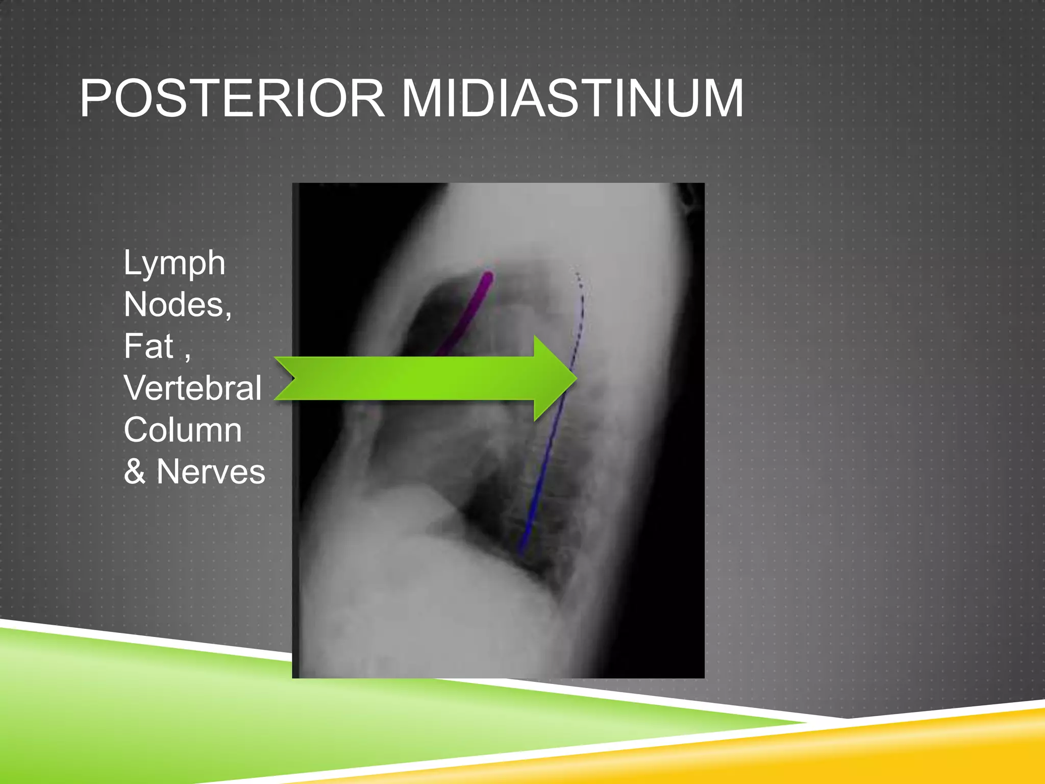 CT ANATOMY OF NORMAL MEDIASTINUM MADE EASY | PPTX