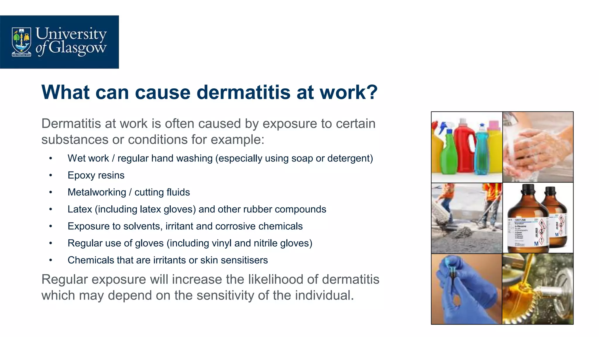 Eczema/ppt | PPTX