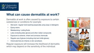 Eczema/ppt | PPTX