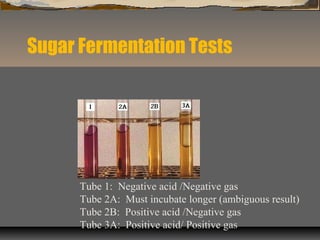 Media and biochemical tests | PPT