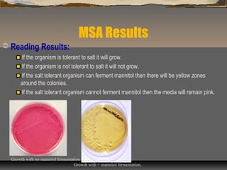 Media biochemical tests | PPT