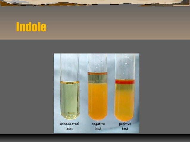 Media biochemical tests | PPT