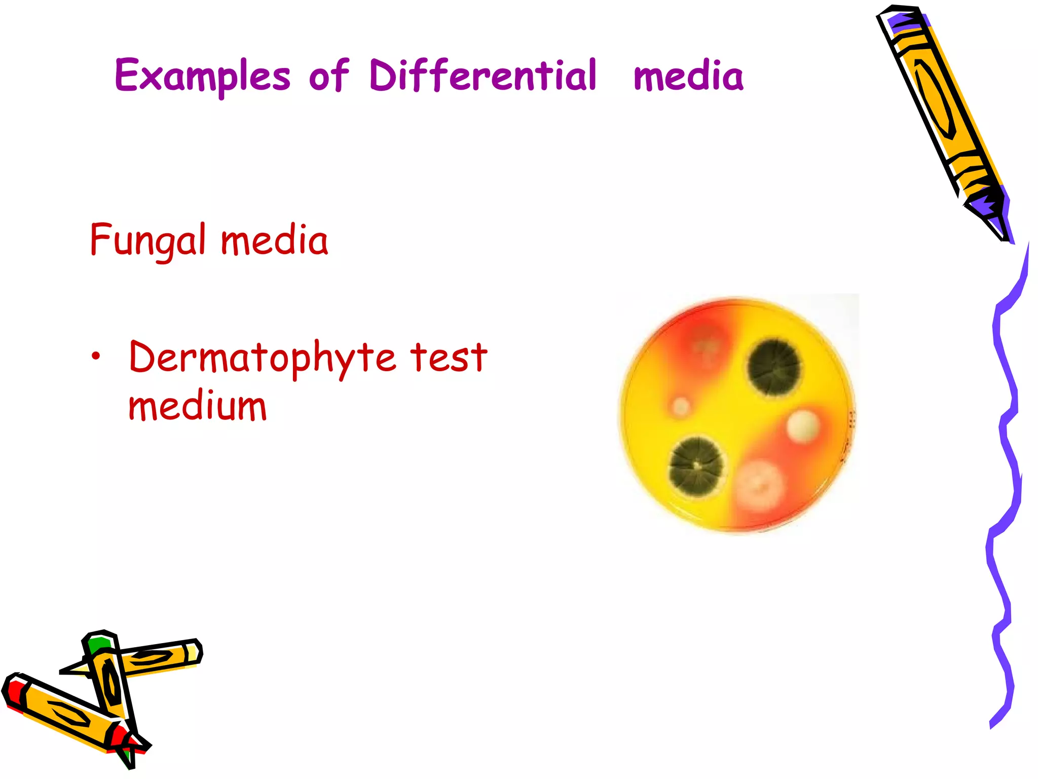 Media in microbiology | PPT