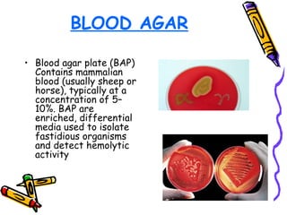 Media in microbiology | PPT
