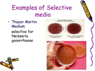 Media in microbiology | PPT